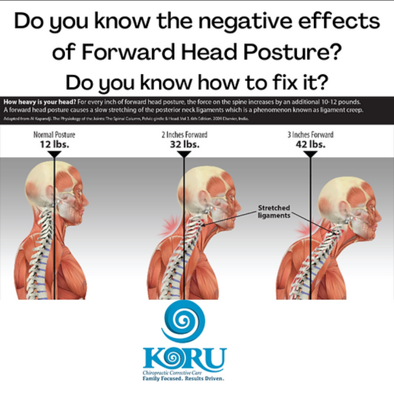 How To Fix Forward Head Posture - Koru Chiropractic