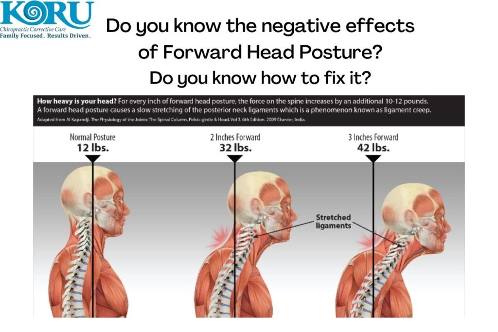 How To Fix Forward Head Posture - Koru Chiropractic
